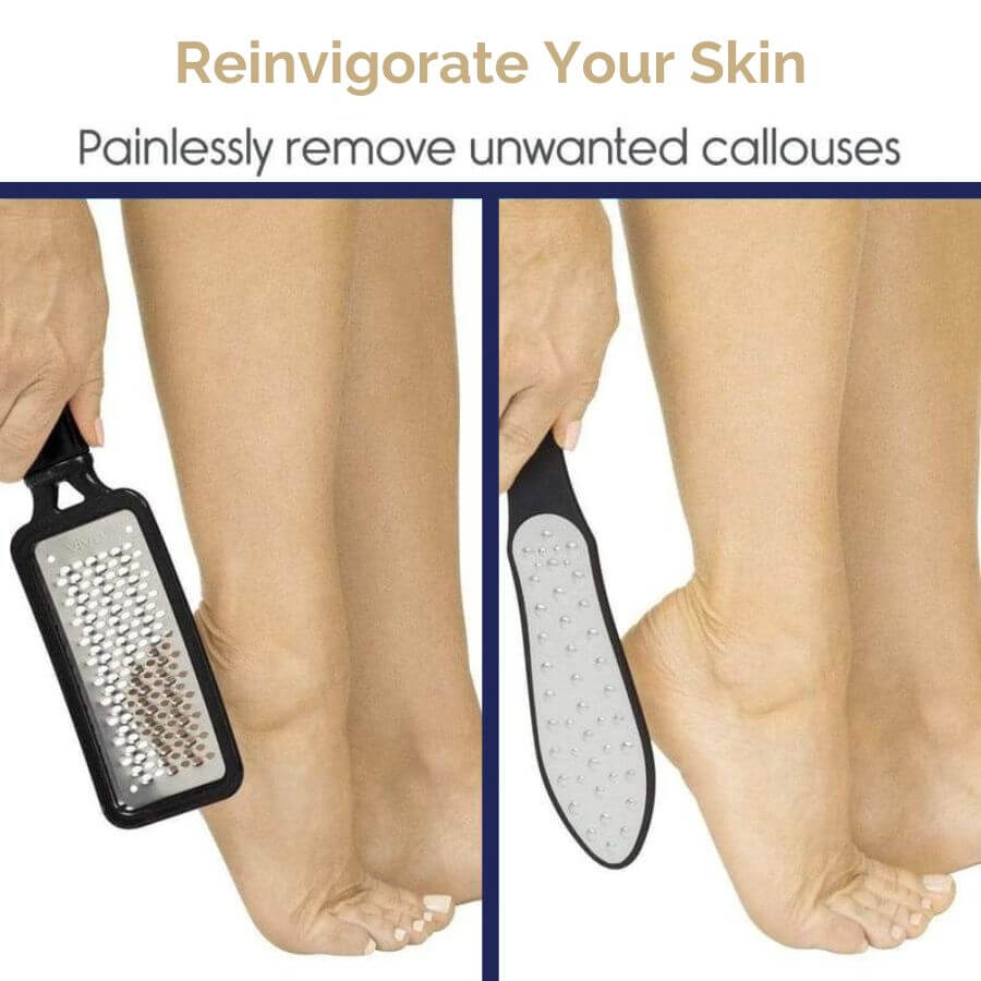 Vive Foot File - 3 Piece Set – State Medical Equipment